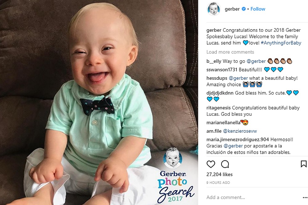 The 2018 Gerber Baby Contest Winner Is the First to Have Down Syndrome